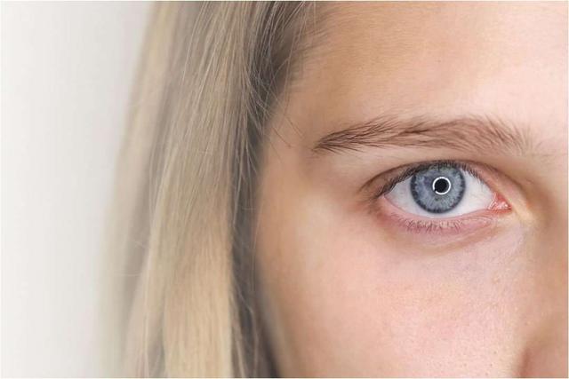 Mydriasis: Causes, Symptoms, Treatment & Prevention Guide