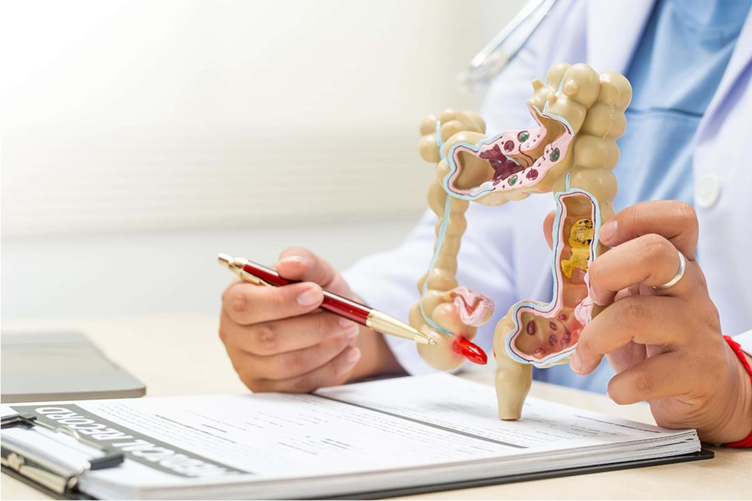 Appendicitis: Causes, Symptoms, Treatment & Recovery Guide