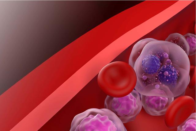 Blood Cancer: Symptoms, Types, Causes, and Treatment Options