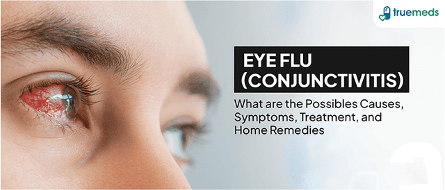 Stye: Causes, Symptoms & Effective Treatment Options