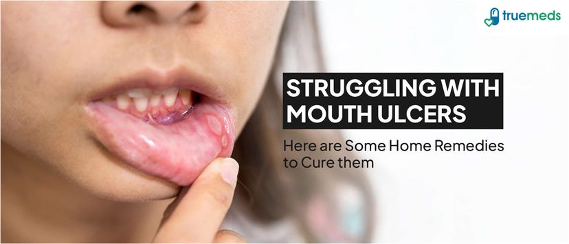 Mouth Larvae (Oral Myiasis): Causes, Symptoms & Treatments